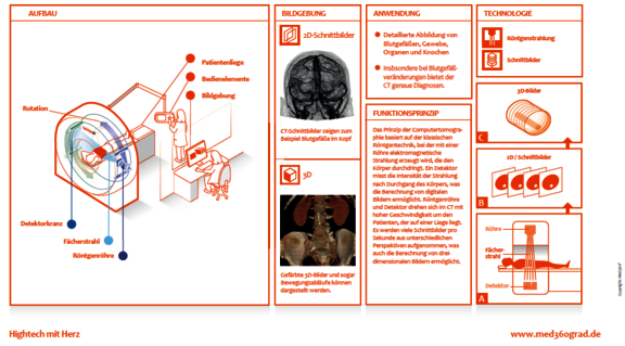 CT - Alles zur Computertomographie